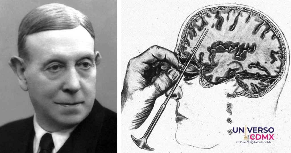 El Trágico Avance Médico Que Ganó Un Premio Nobel: La Lobotomía ...